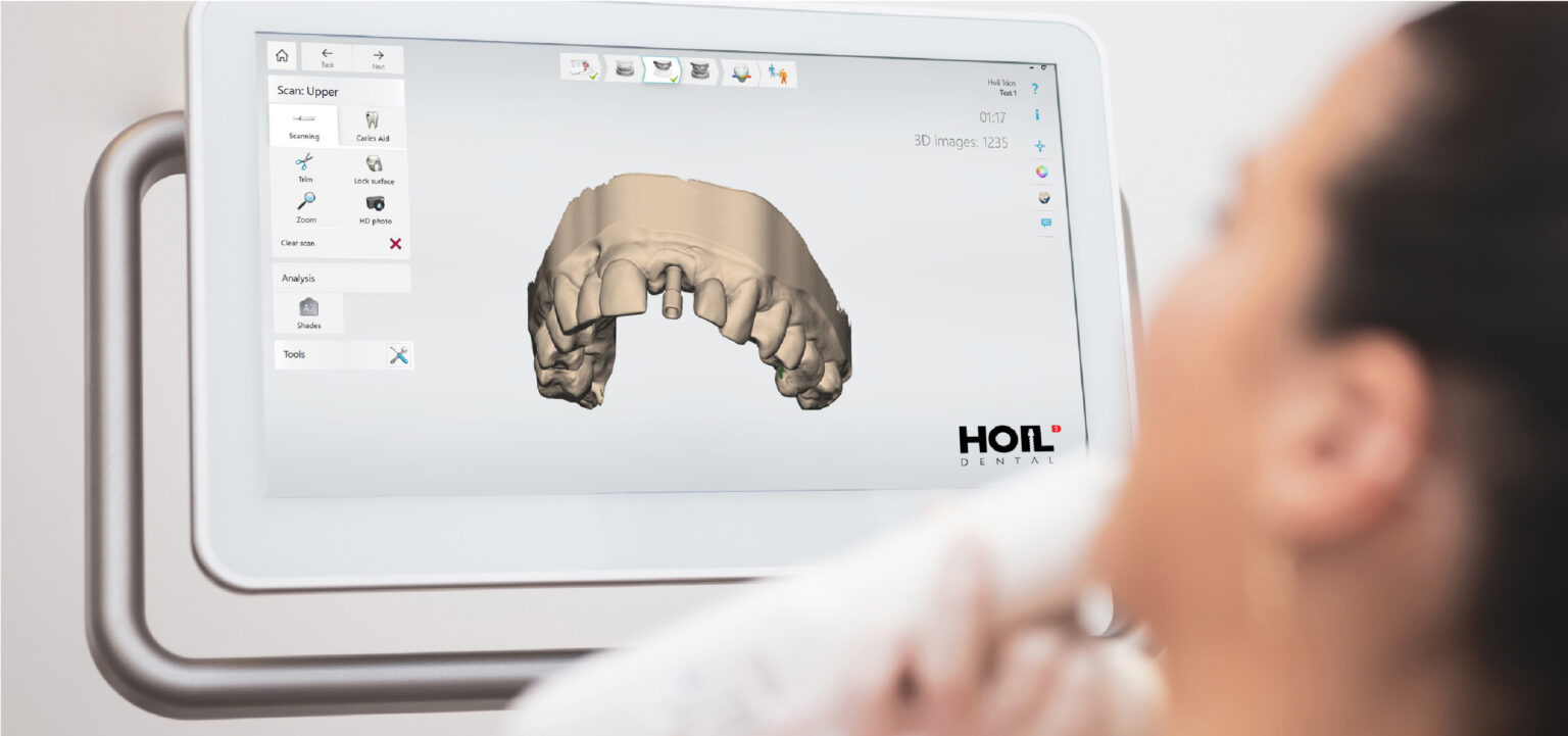 Hoil Scanbody - HOIL DENTAL